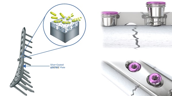 aap Starts Human Clinical Study for Antibacterial Silver Coating Technology
