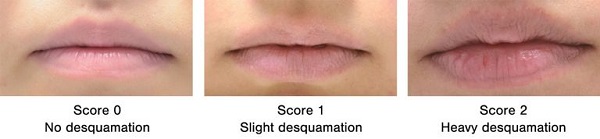 Kao Reports Lip Balm Formulations with Oil and Wax Improve Roughness