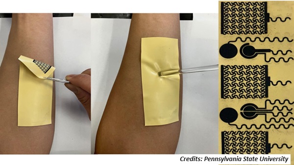 Researchers Innovate Adhesive Smart Skin for Advanced Health Monitoring