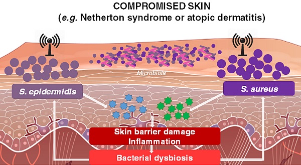 SILAB and University of San Diego Reveal the Role of Skin Microbiota in ...