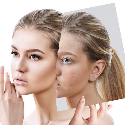 Soothing Effect Dedicated to Sensitive Skin